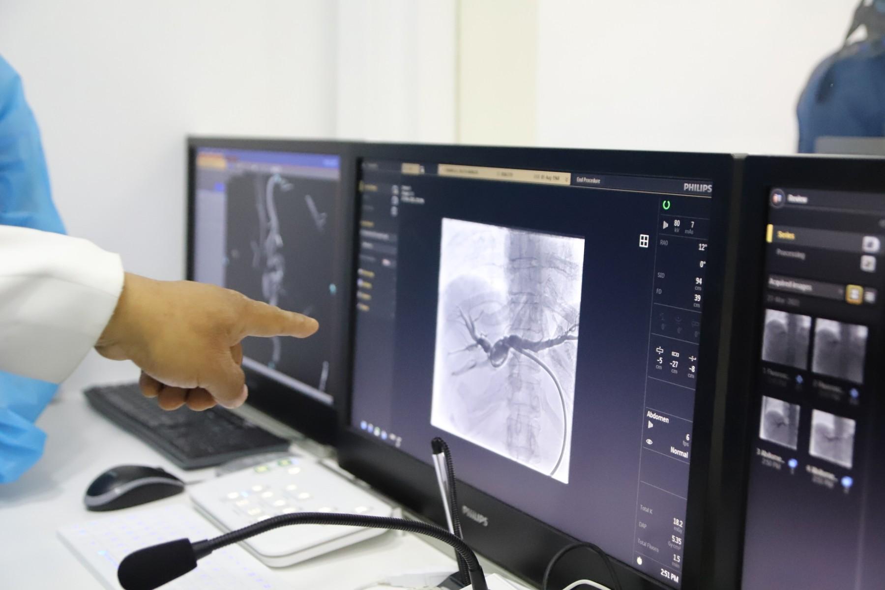 4DOH – Arlin Salonga | CLTV36